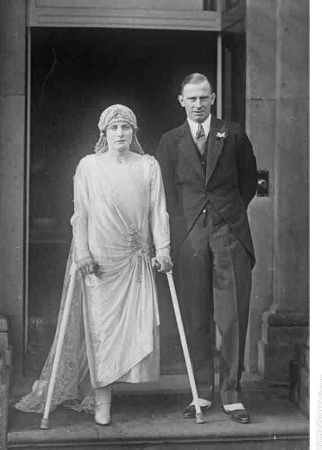 41 Amazing Vintage Photos of Beautiful Monopede Women From the Past ...